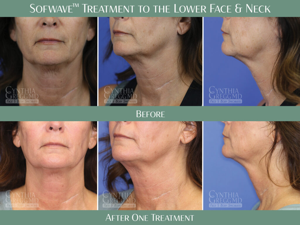 Skincare - Cynthia Gregg MD | Face & Body Specialists