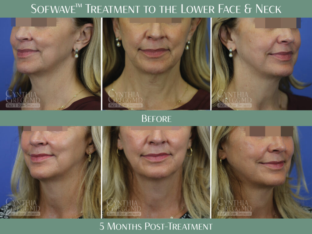 Skincare - Cynthia Gregg MD | Face & Body Specialists